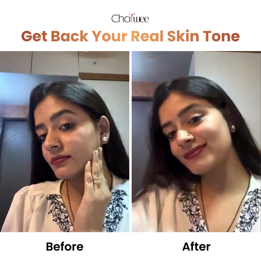 Charwee Dark Spot Corrector For Face with Active Brightening Blend