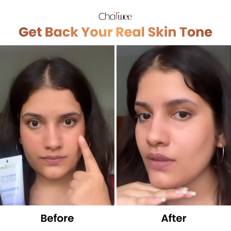 Charwee Dark Spot Corrector For Face with Active Brightening Blend