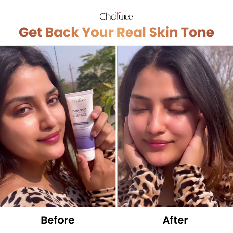 Charwee Dark Spot Corrector For Face with Active Brightening Blend